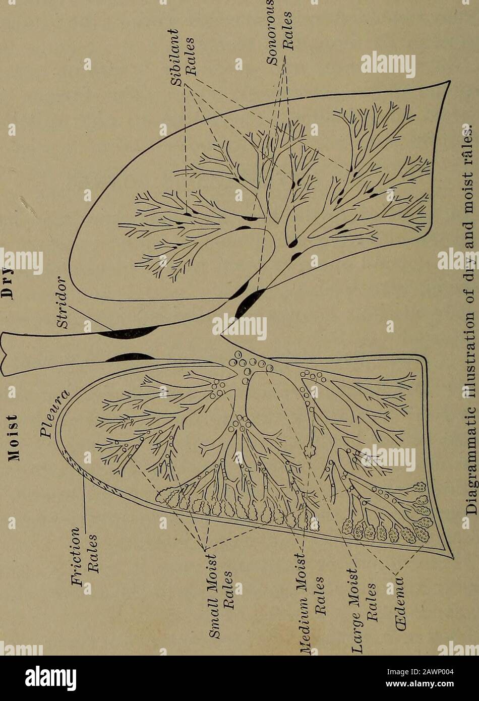 Bronchial mucous membrane hi-res stock photography and images - Alamy