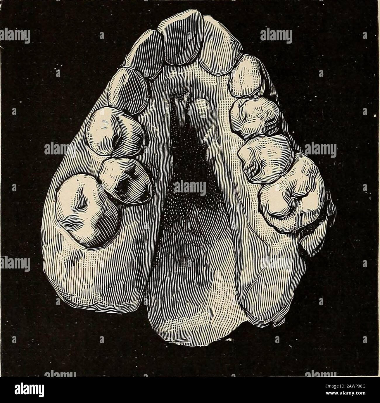 Nervous and mental diseases . Fig. 281.—Palate with Gothic arch.. Fig ...