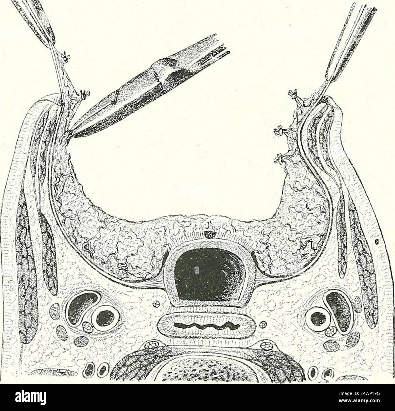Surgical therapeutics and operative technique . Fig. 346 ...