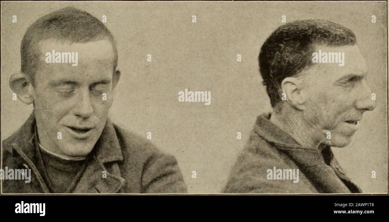 Imbecile hi-res stock photography and images - Alamy