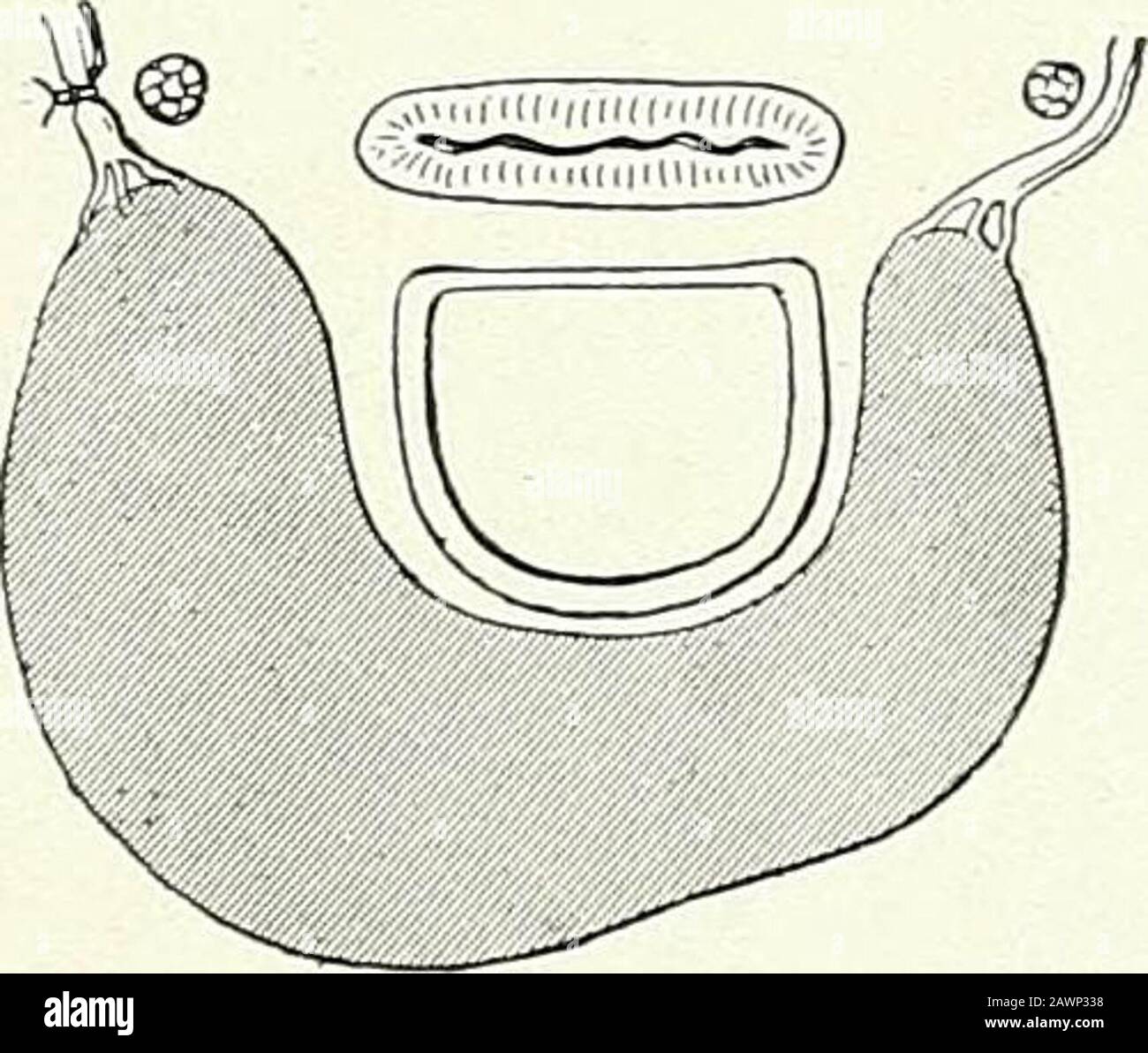 Surgical therapeutics and operative technique . e tumour, so as to ...