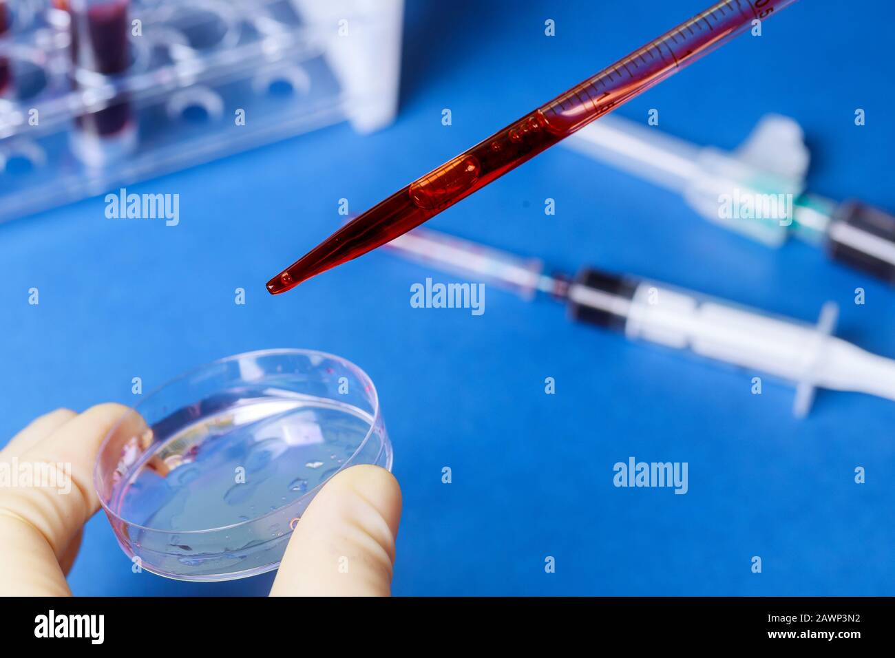 Blood sample with pipette and petri dish others blood test tubes in a ...
