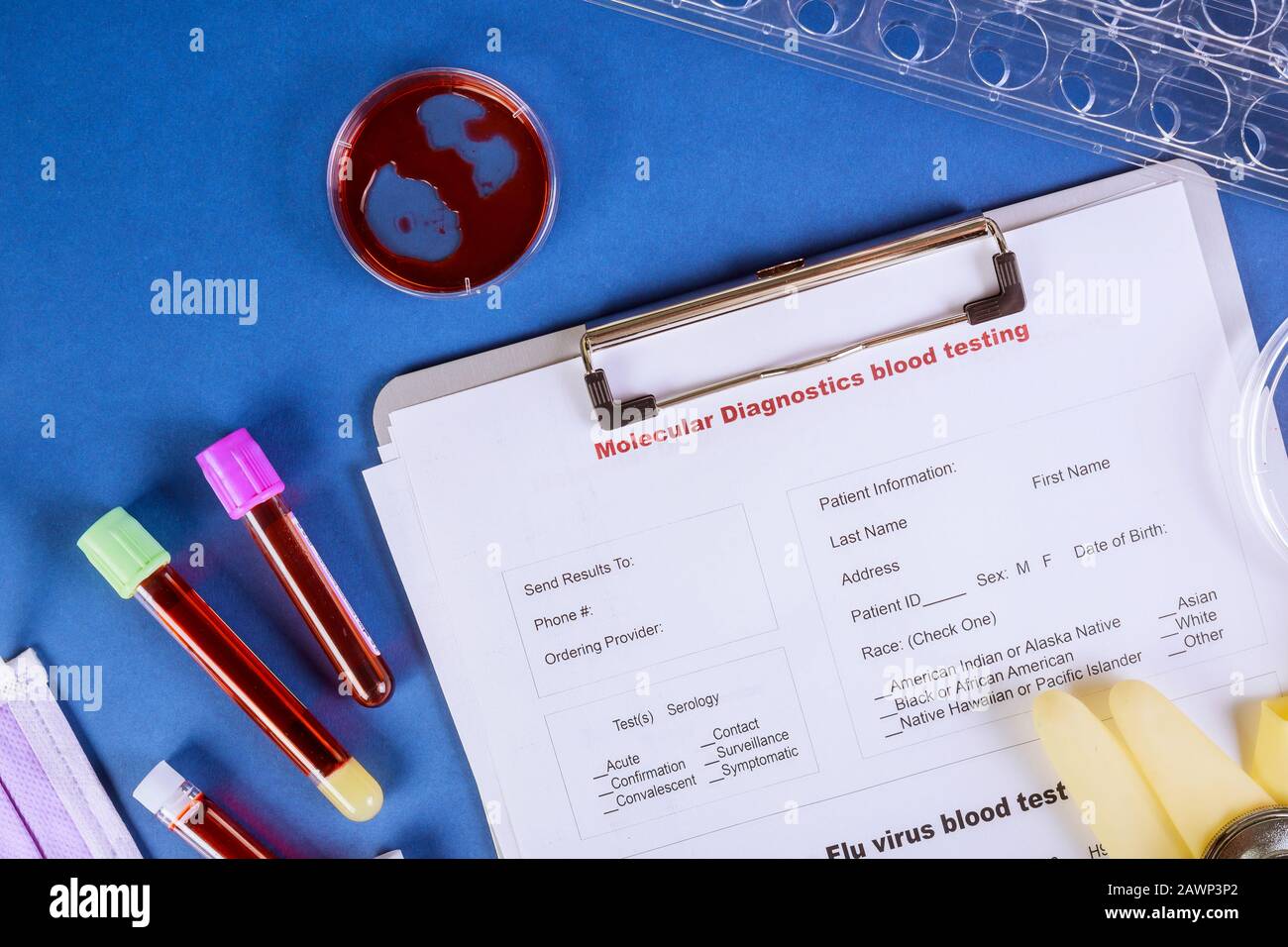 Blood sample many others blood test tubes exam analysis hospital ...