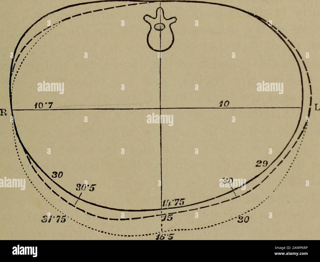 Physical diagnosis, including diseases of the thoracic and abdominal ...