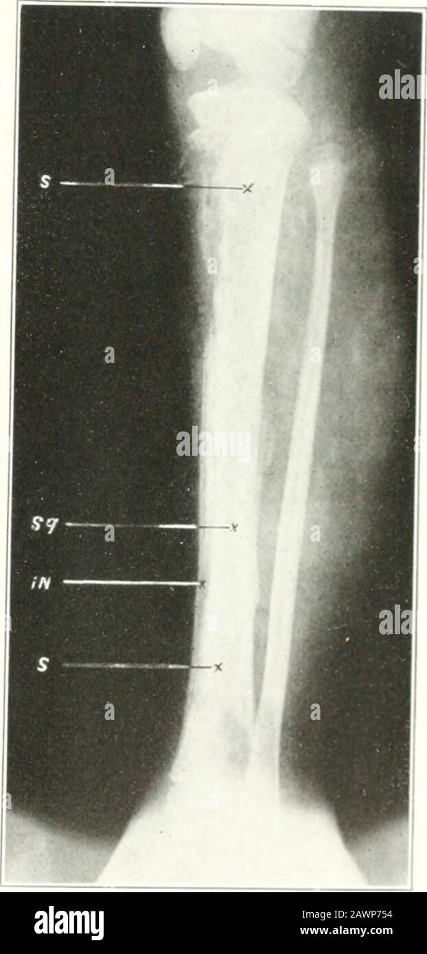 Deadspace hi-res stock photography and images - Alamy