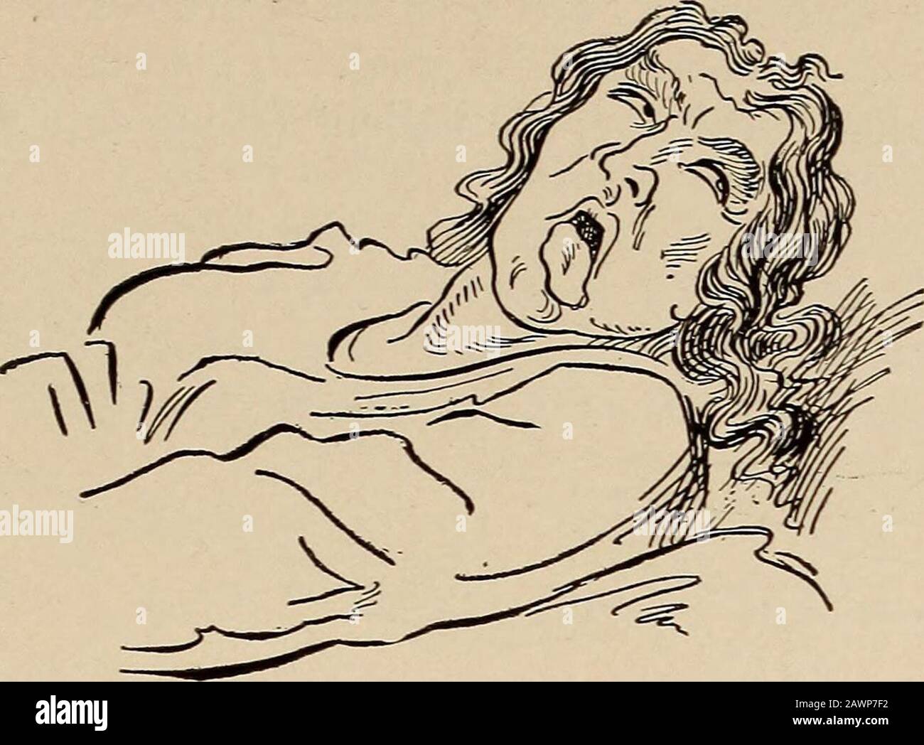 Nervous and mental diseases . ht cry. Thepatient is rigid ; the face is ...