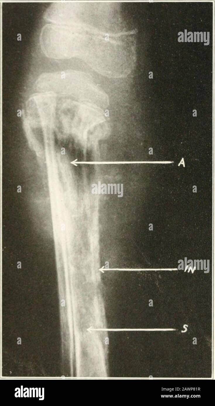 Studies from the laboratories of the Deptof Surgery . Fig. 22 ...