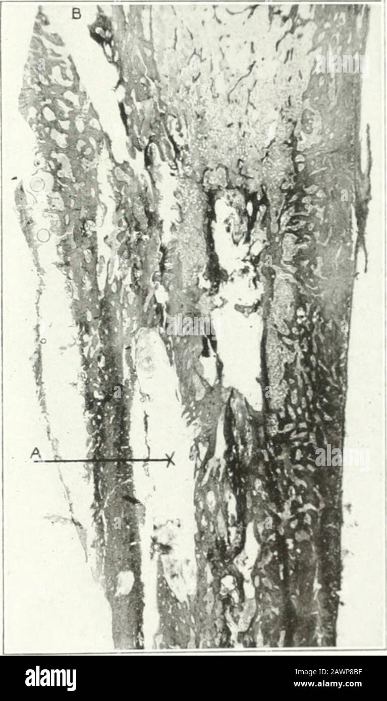 Studies from the laboratories of the Deptof Surgery . The inlay graft ...