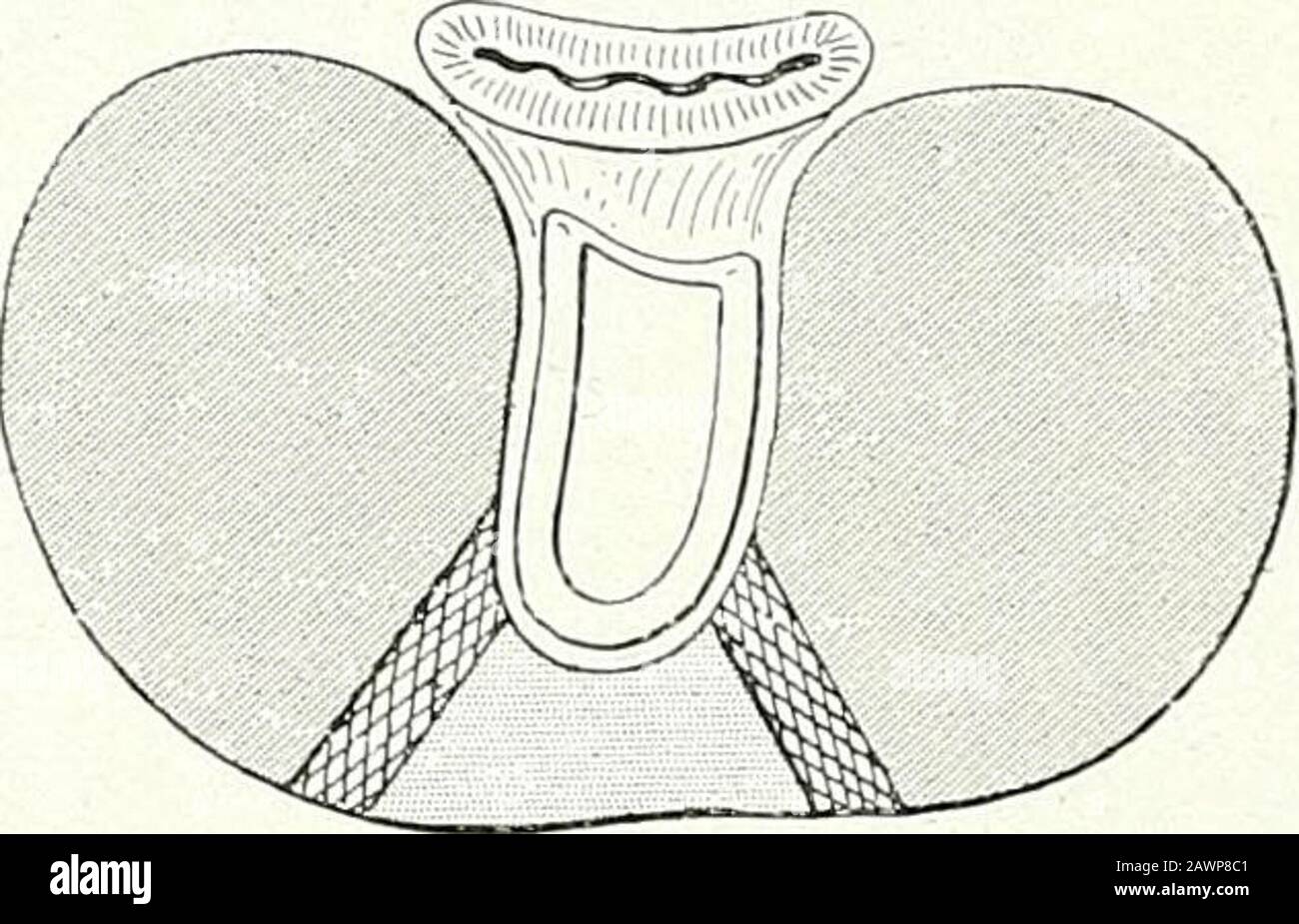 Parenchymatous hi-res stock photography and images - Alamy