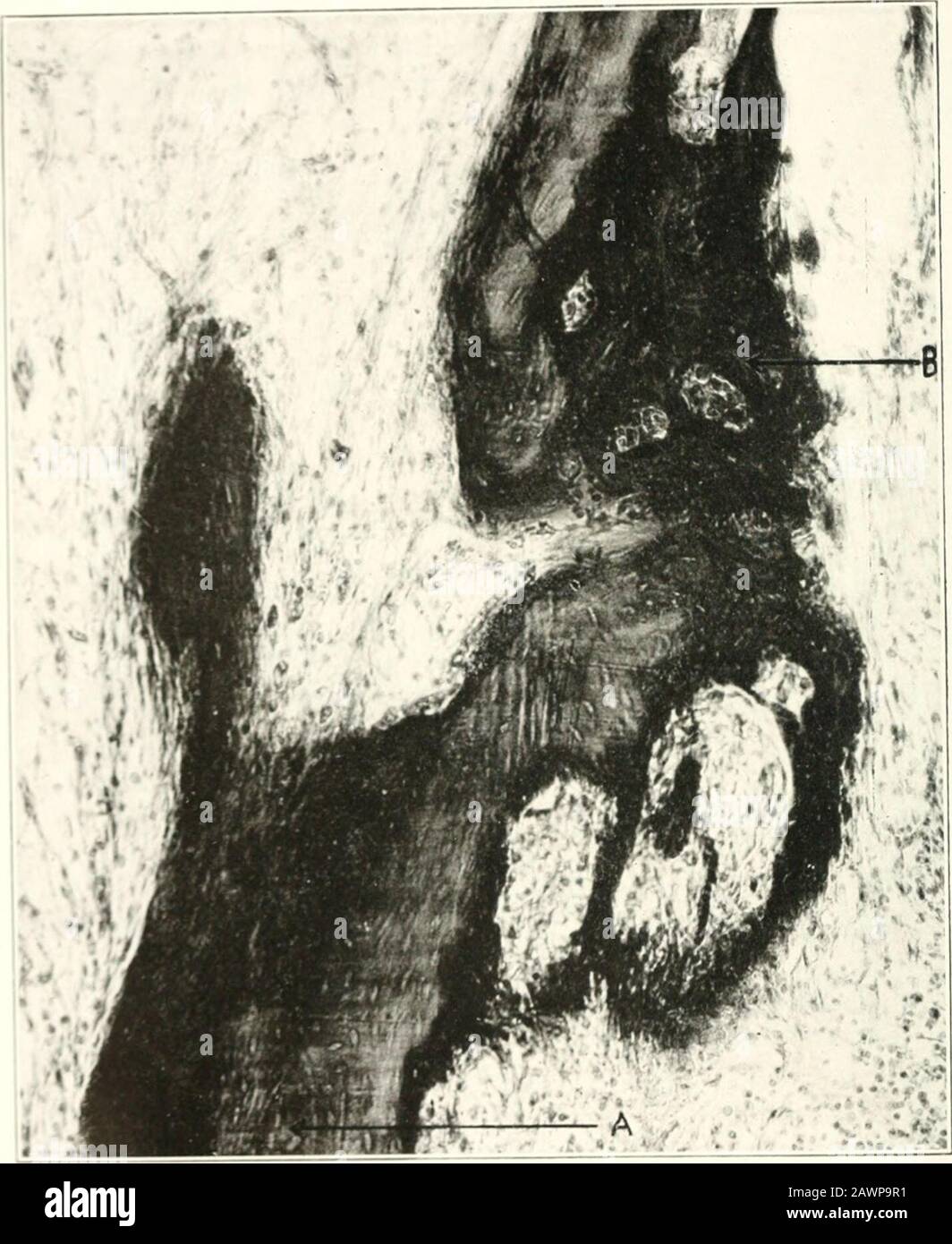 Exuberant granulation hi-res stock photography and images - Alamy