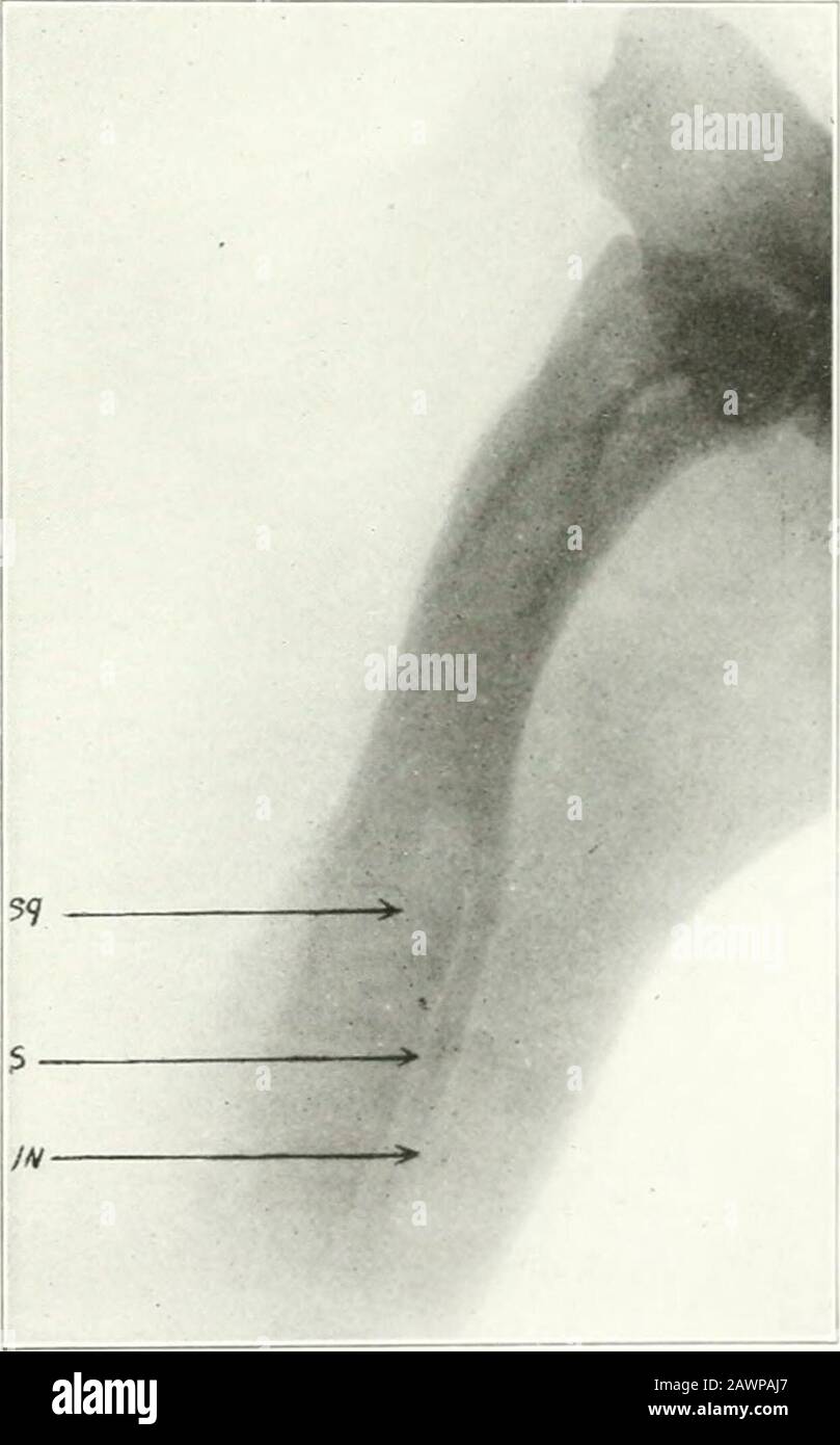 Studies from the laboratories of the Deptof Surgery . Fig. 13 ...