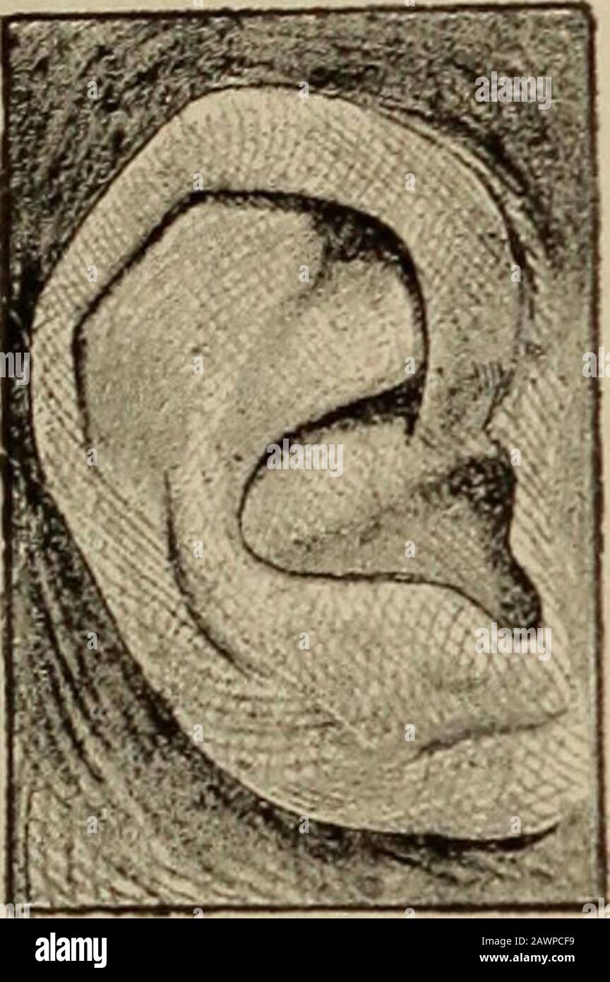 Antitragus hi-res stock photography and images - Alamy