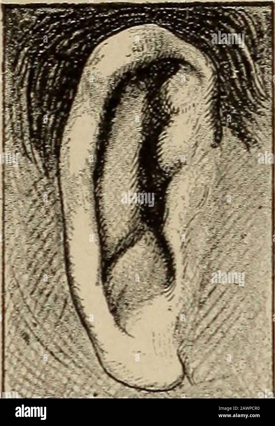 Helix band hi-res stock photography and images - Alamy