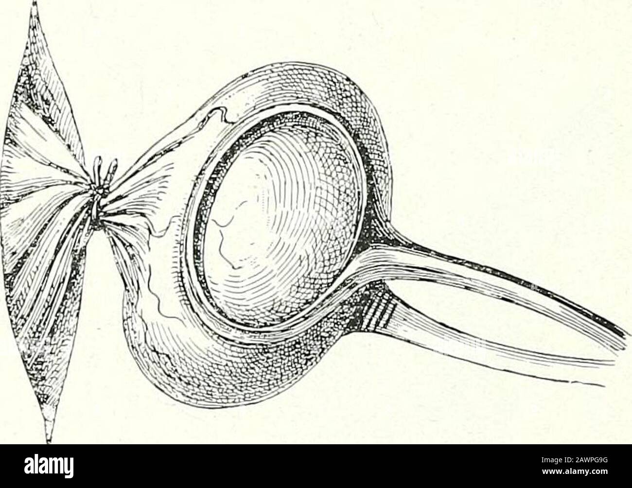 Surgical therapeutics and operative technique . Fig. 303.—Vascular ...