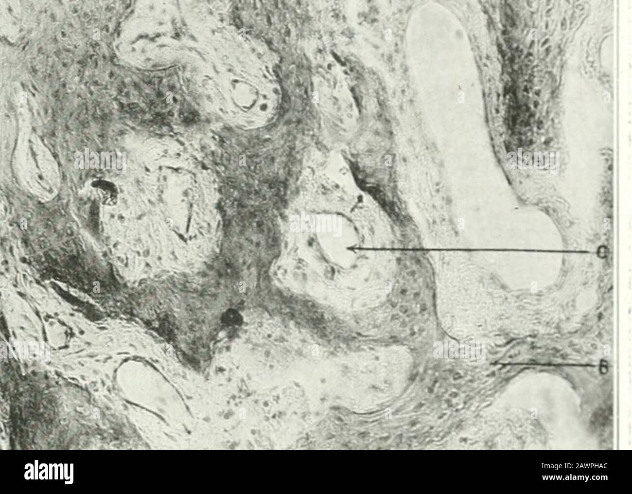 Radius ulna comminuted fracture hi-res stock photography and images - Alamy Radius ulna comminuted fracture hi-res stock photography and images - Alamy