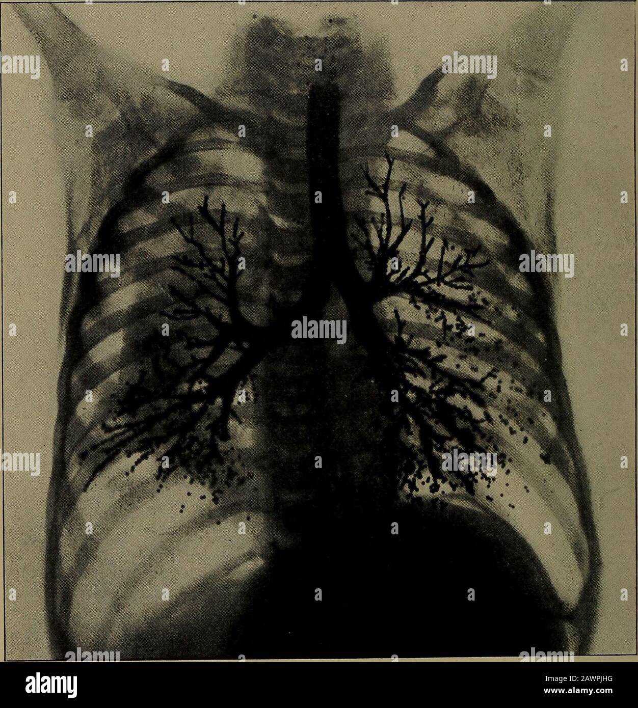 Physical diagnosis, including diseases of the thoracic and abdominal ...