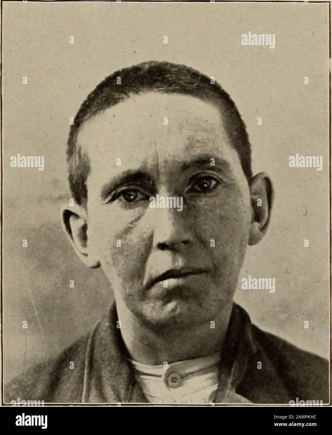 Retrognathism hi-res stock photography and images - Alamy