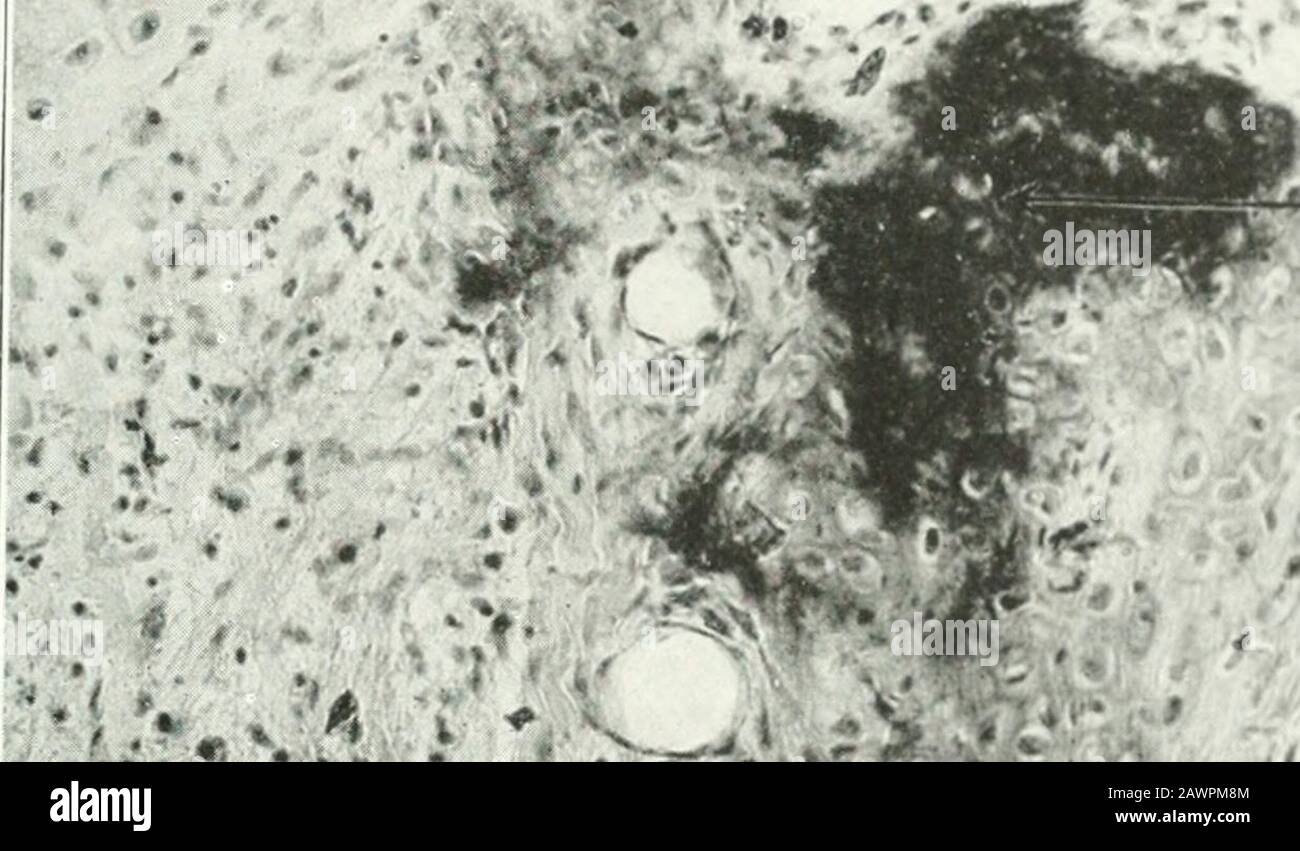 Studies from the laboratories of the Deptof Surgery . Pig. 1.—Early ...