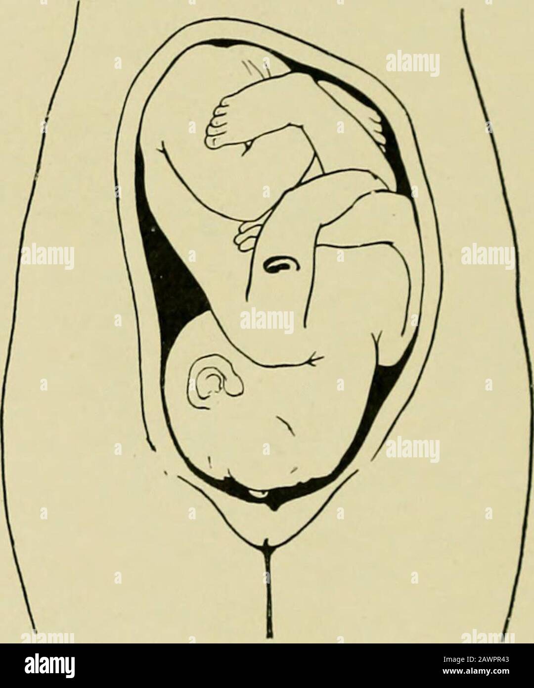 Dolichocephalic hi-res stock photography and images - Alamy