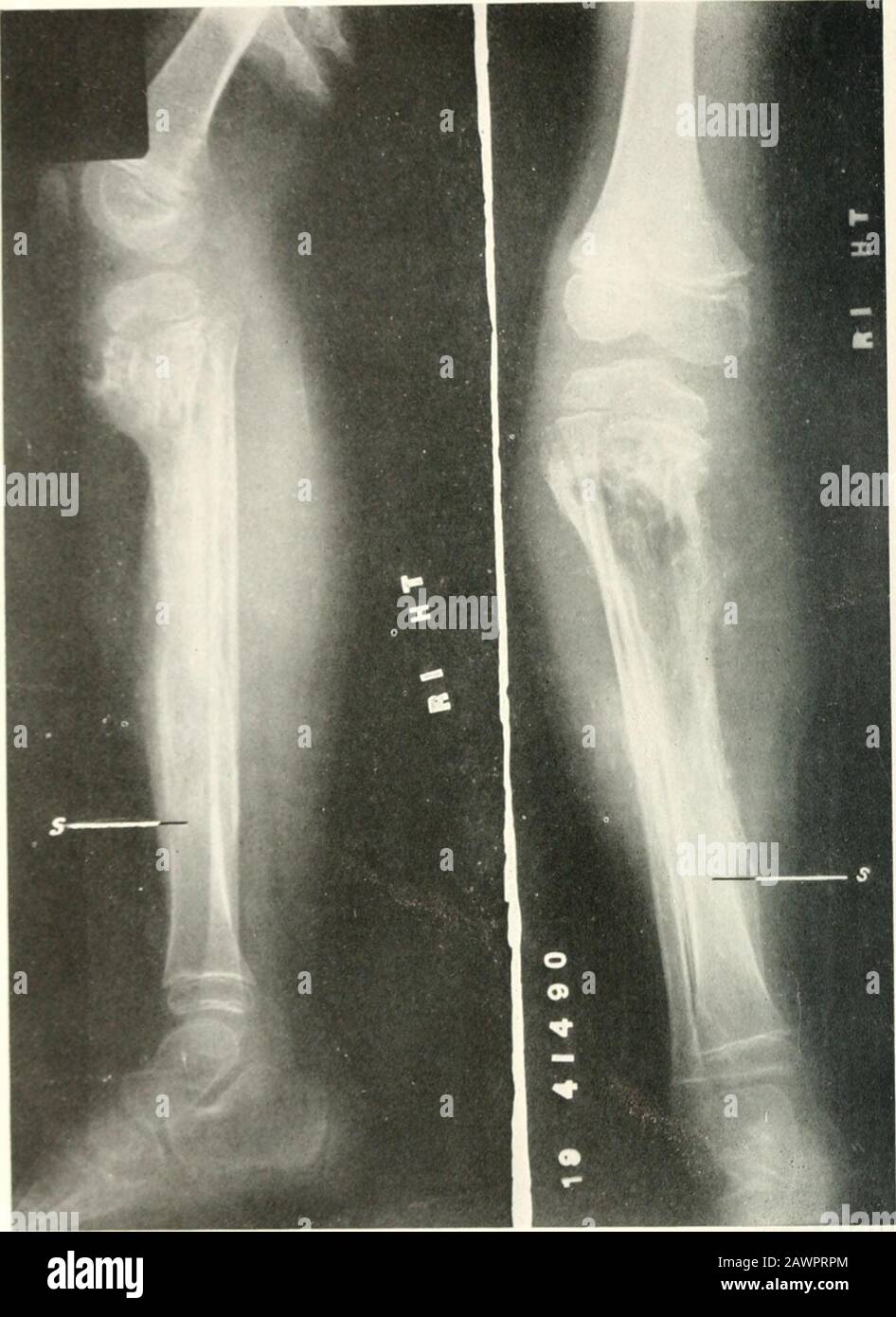 Studies from the laboratories of the Deptof Surgery . Fig. is.—Clinical ...
