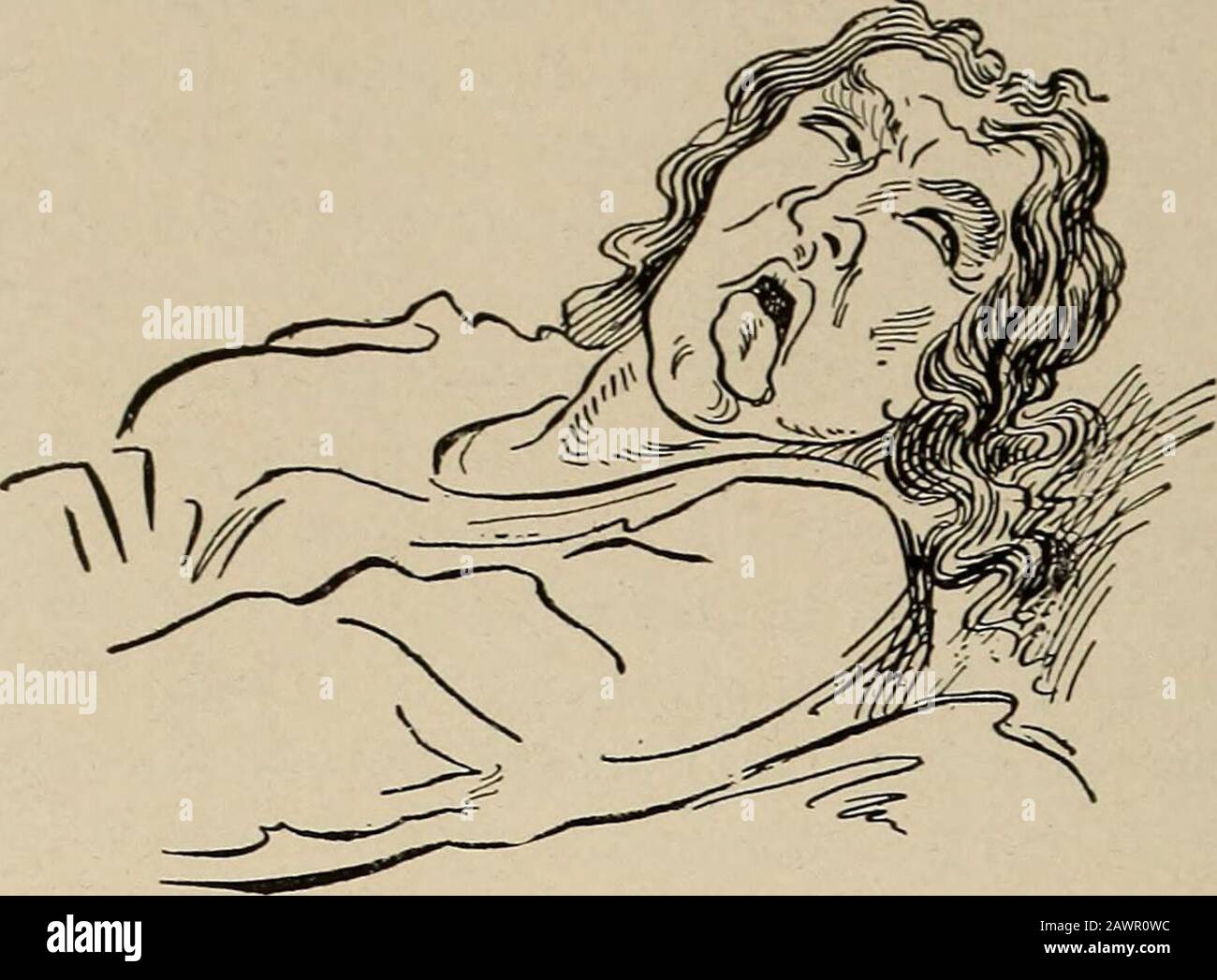 Circumduction Figure