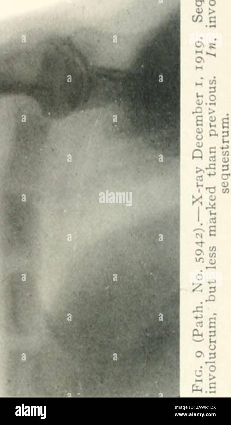 Studies from the laboratories of the Deptof Surgery . Fig. tB (Path ...