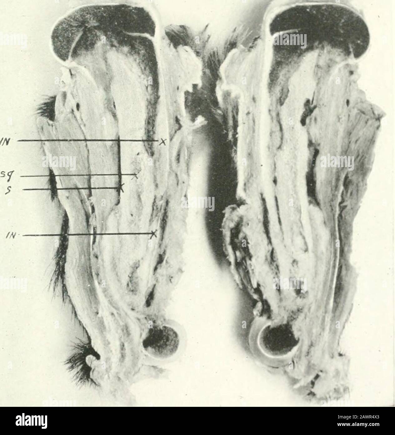 Sequestrum hi-res stock photography and images - Alamy