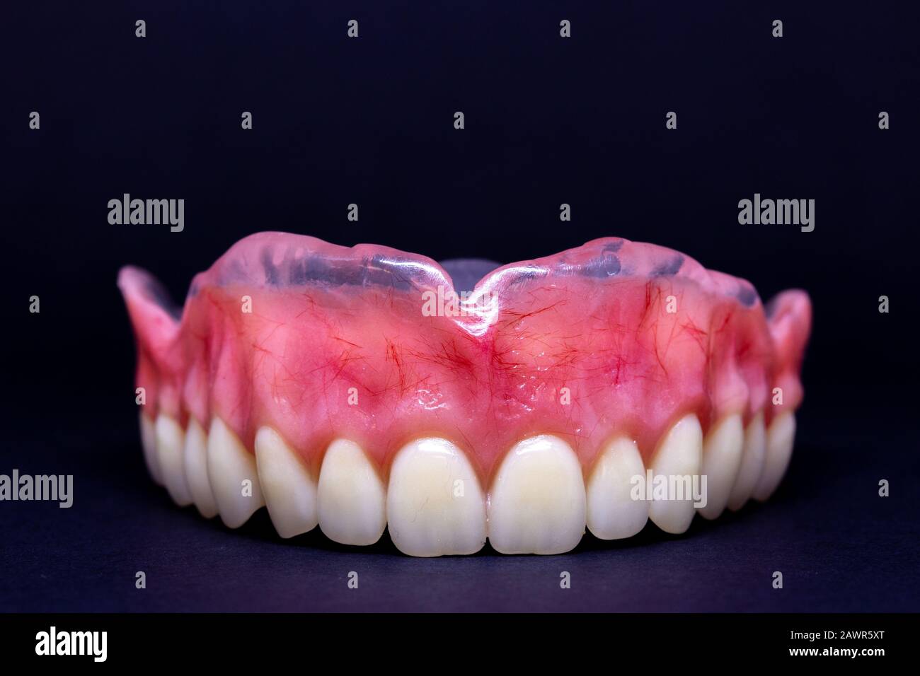 Dental prosthesis close up with macro lens Stock Photo - Alamy
