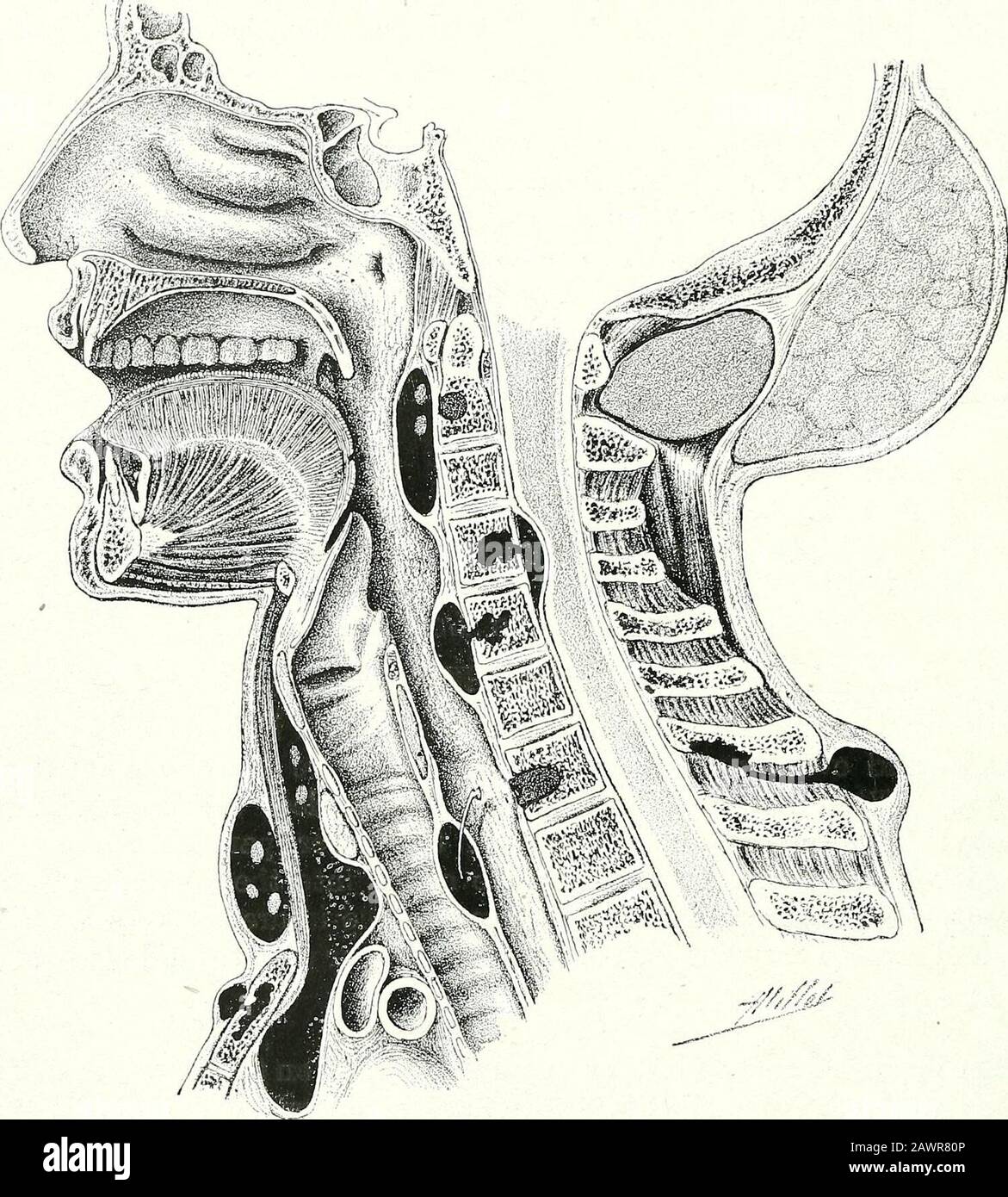 Spasmodic muscles hi-res stock photography and images - Alamy