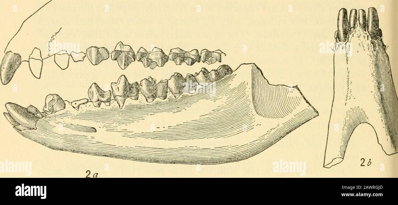 Ramus of mandible hi-res stock photography and images - Alamy