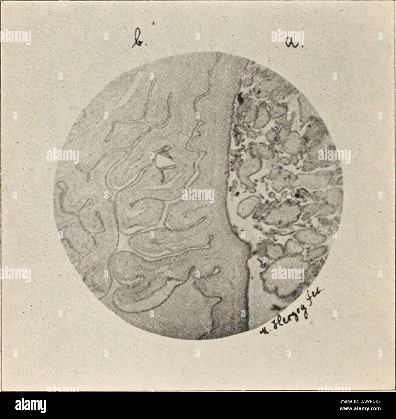 American gynaecological and obstetrical journal. . tered that part of ...