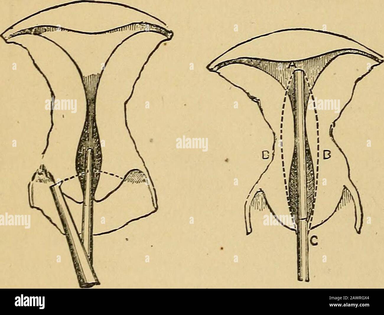 Cervical stenosis hi-res stock photography and images - Alamy