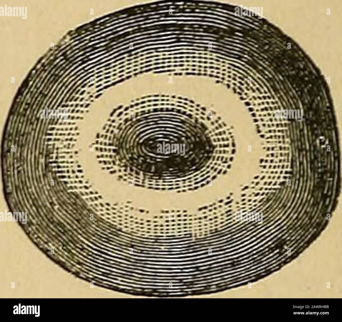 Cervical stenosis hi-res stock photography and images - Alamy