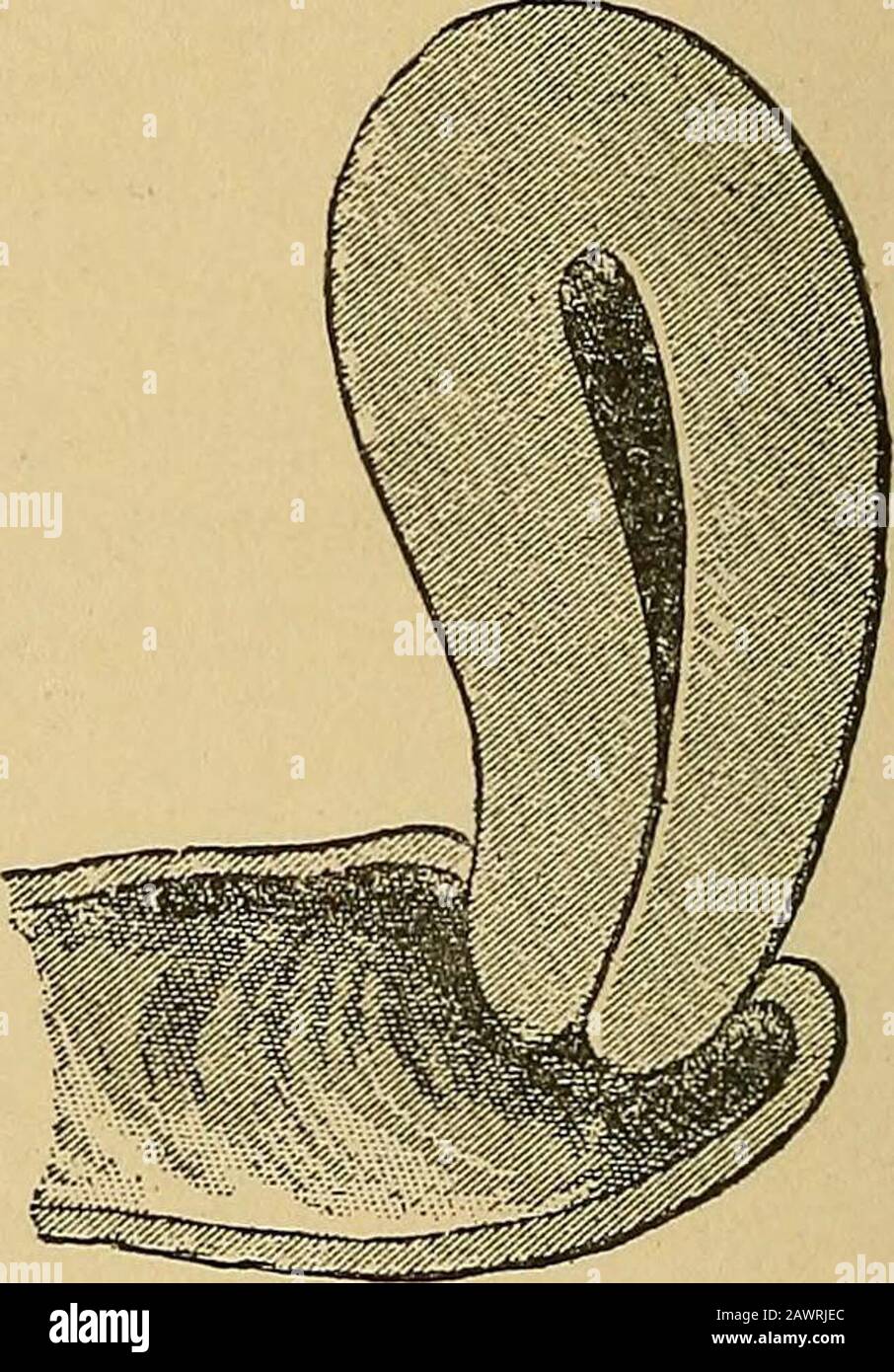Treatise on gynæcology : medical and surgical . Fig. 298.—Cervical ...
