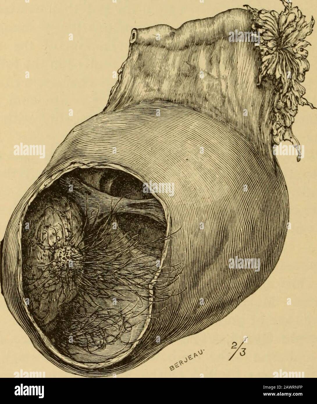 The diseases of women : a handbook for students and practitioners . to ...