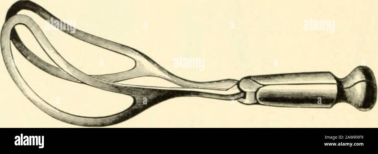 A textbook of obstetrics . Fig. 517.—Simpsons forceps.. Fig. 51