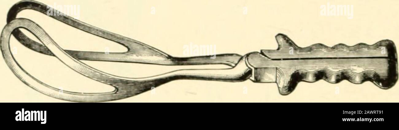 A textbook of obstetrics . Fig. 516. — Hodges forceps.. Fig. 517 ...