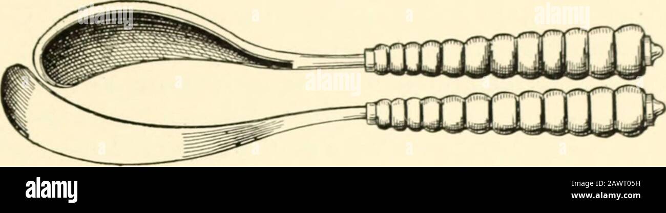 A textbook of obstetrics . FORCEPS. /-o 5 i j.1 The Chamberlens were ...
