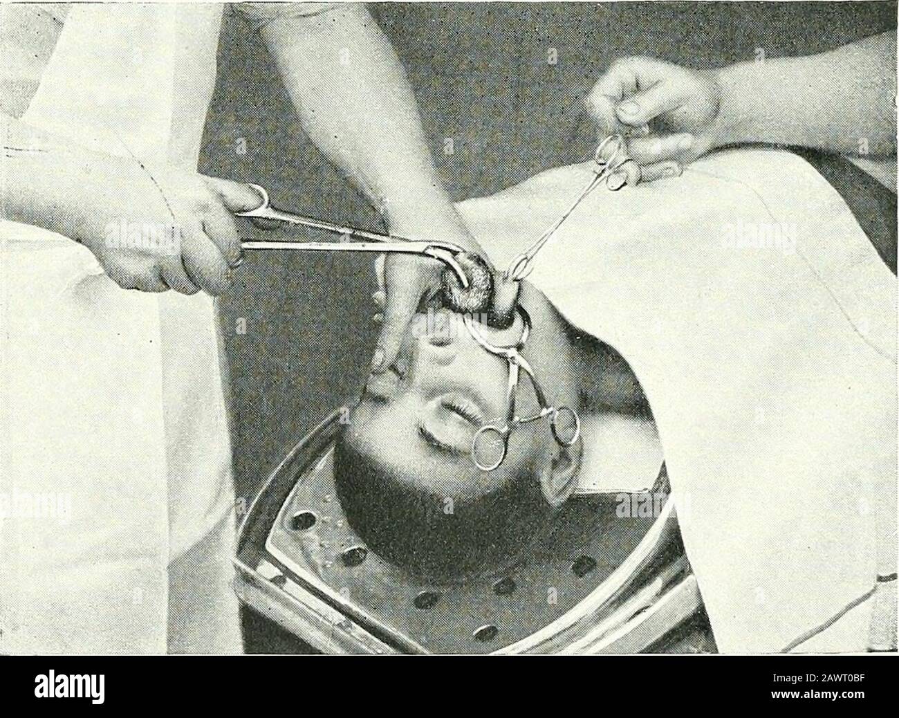 Sphenoidal sinus hi-res stock photography and images - Alamy