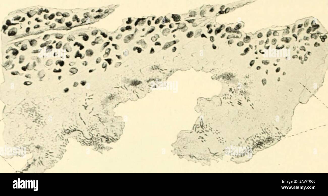 Femoral vein hi-res stock photography and images - Alamy