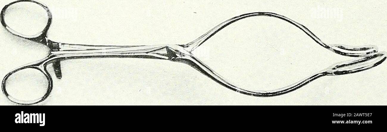 Surgical therapeutics and operative technique . Tig. 232.—Compression ...