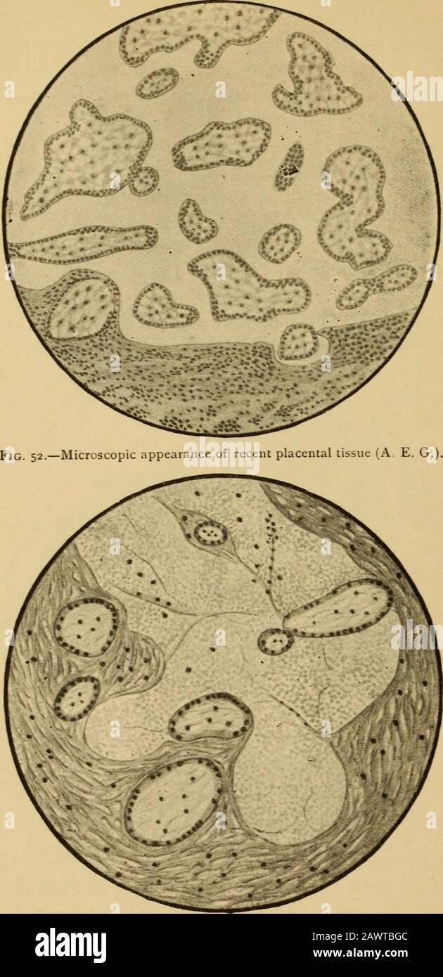 The diseases of women : a handbook for students and practitioners . Fig ...