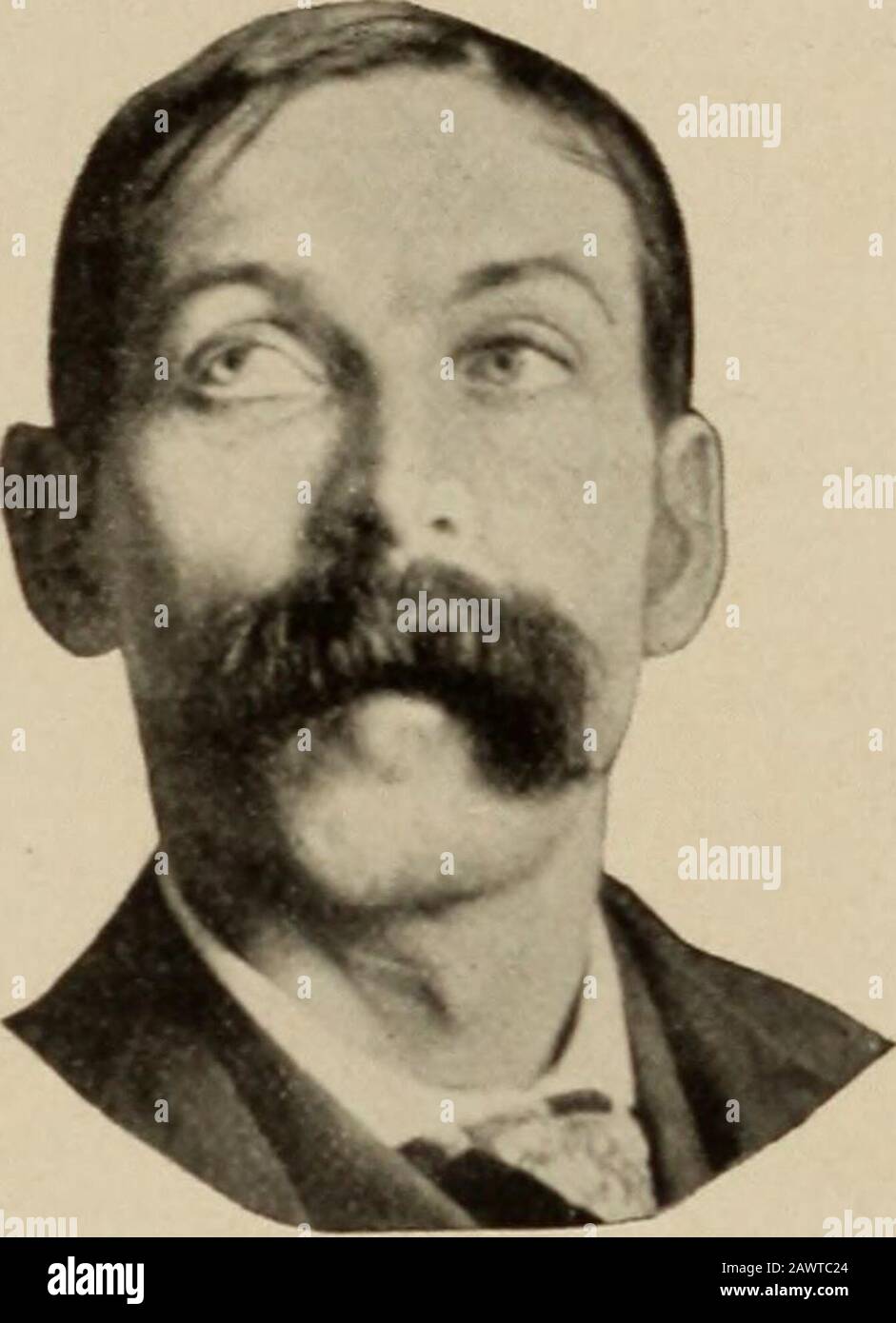 Nervous and mental diseases . penetrating blood-vessel. They comport ...