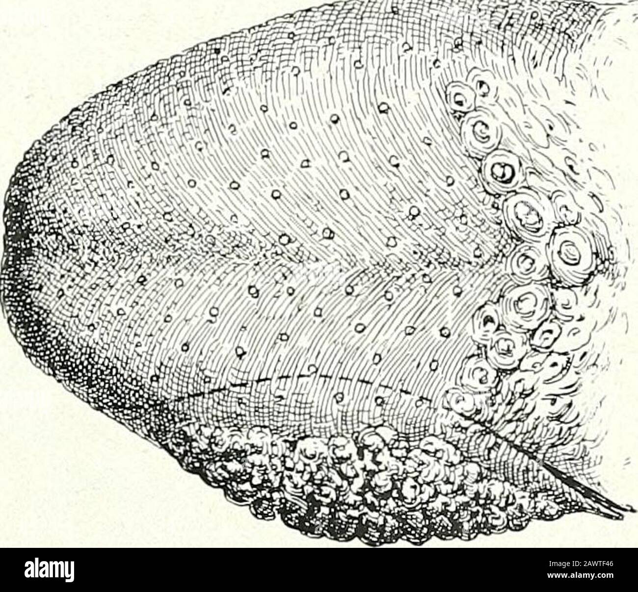 Lesion tongue hi-res stock photography and images - Alamy