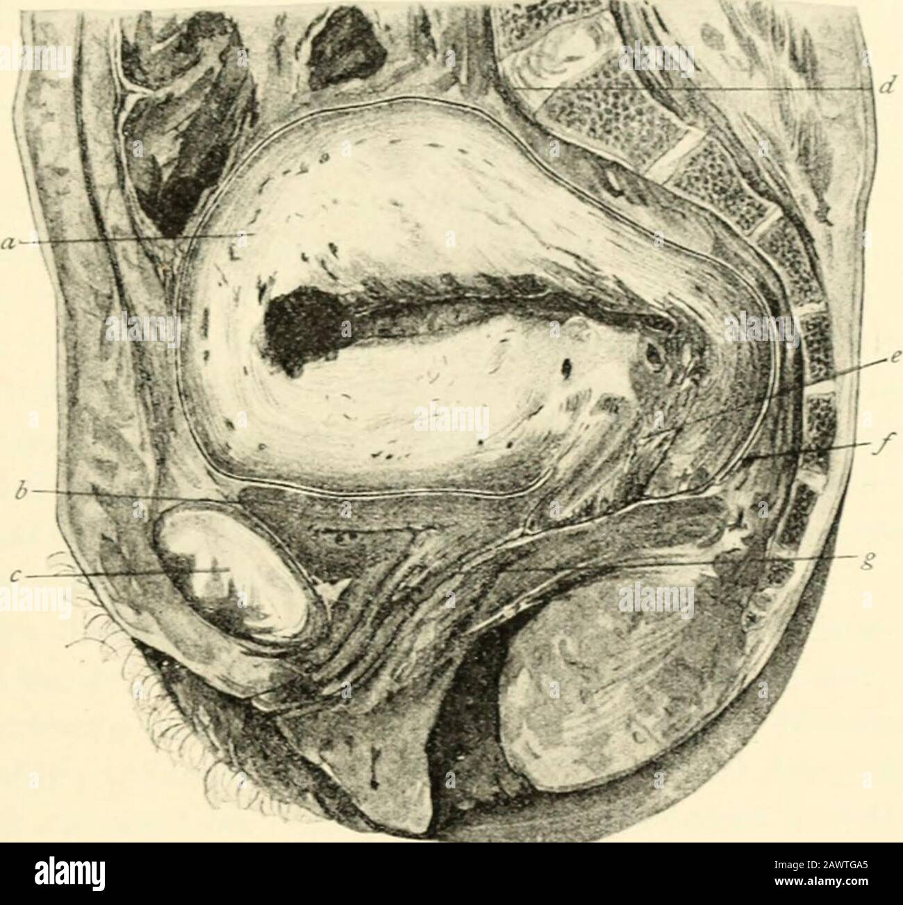 Fundus Is Firm