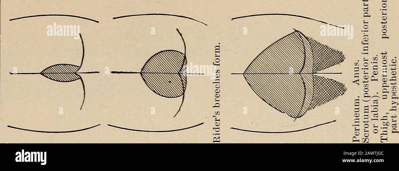 Diminished mental hi-res stock photography and images - Alamy