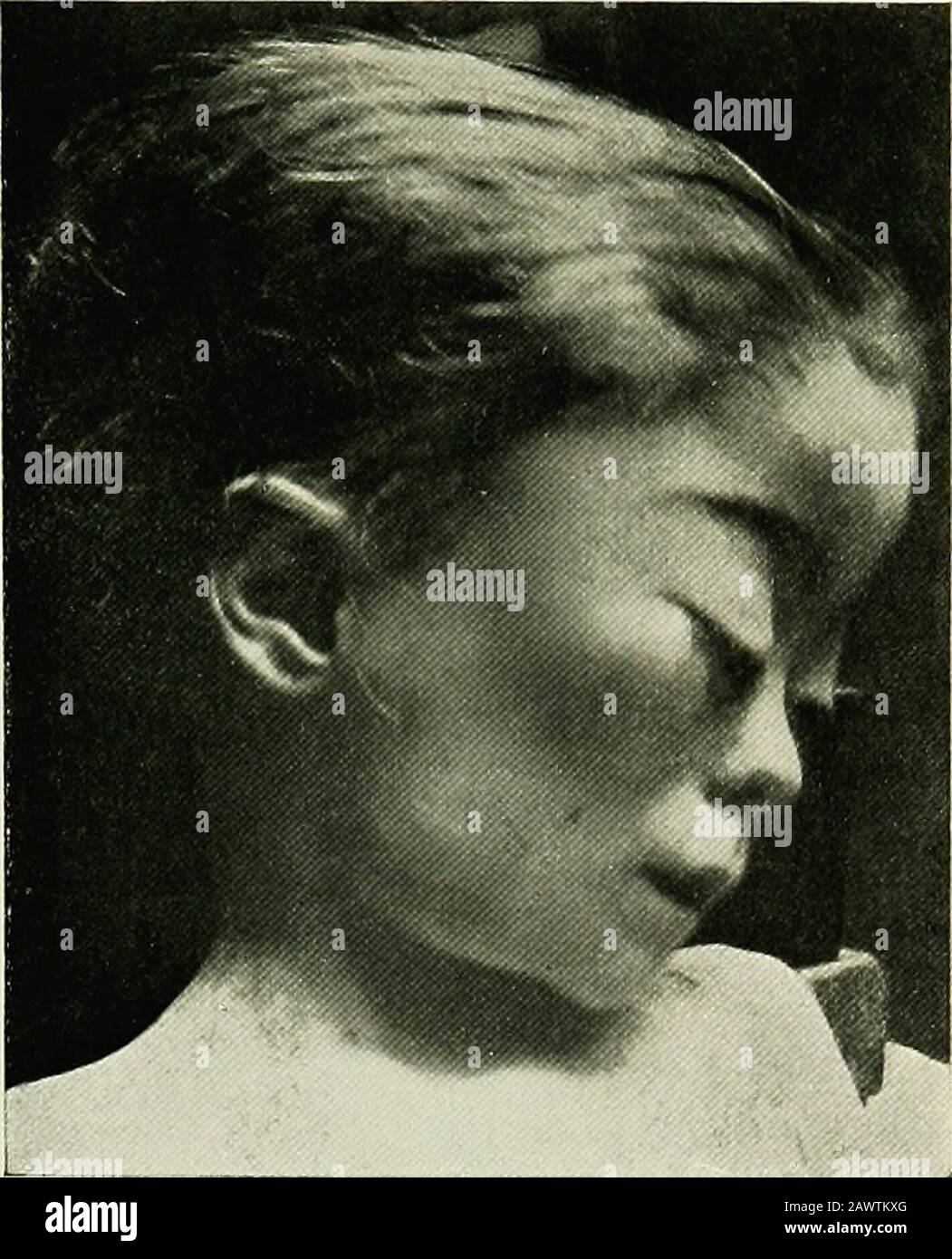 Adrenal medulla glands hi-res stock photography and images - Alamy