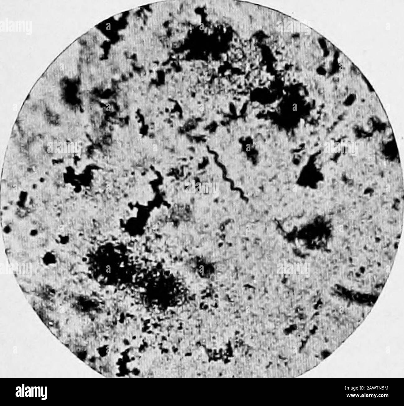 Giemsa stain hi-res stock photography and images - Alamy