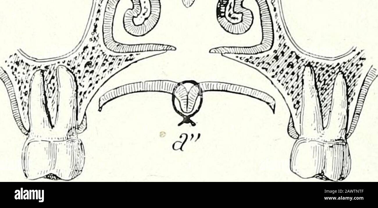 Surgical therapeutics and operative technique . Fig. 200.—Urano ...