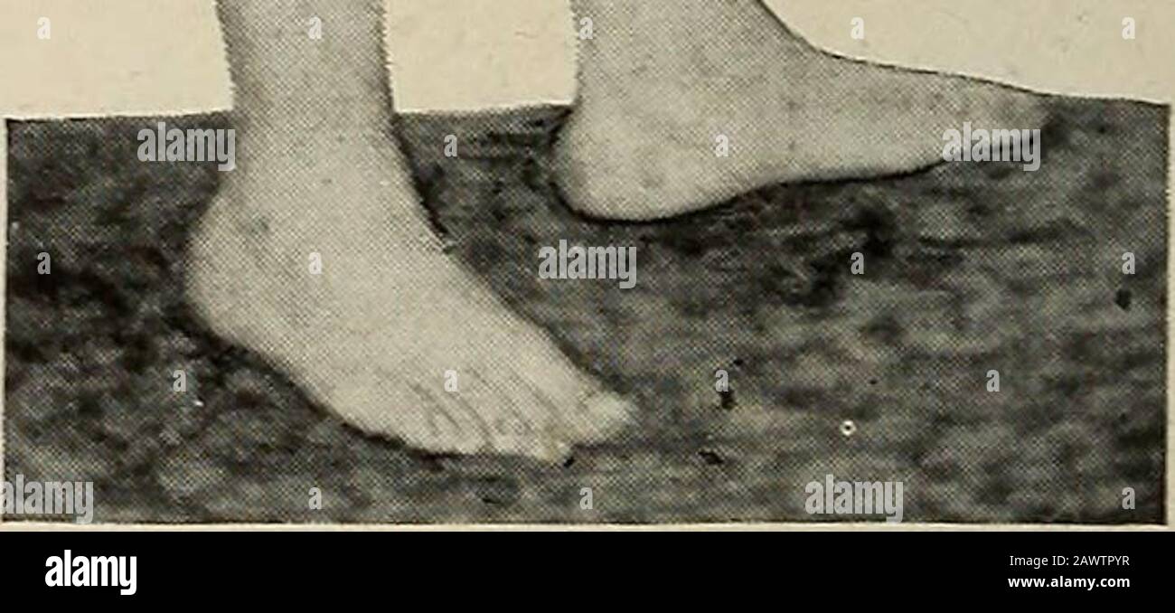 186 foot high hi-res stock photography and images - Alamy